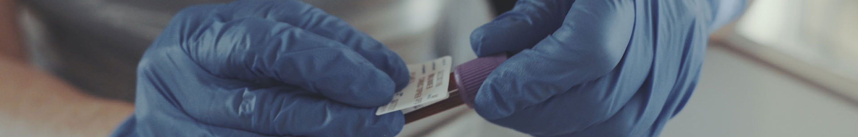 Blood tests procedure explained | Nuffield Health