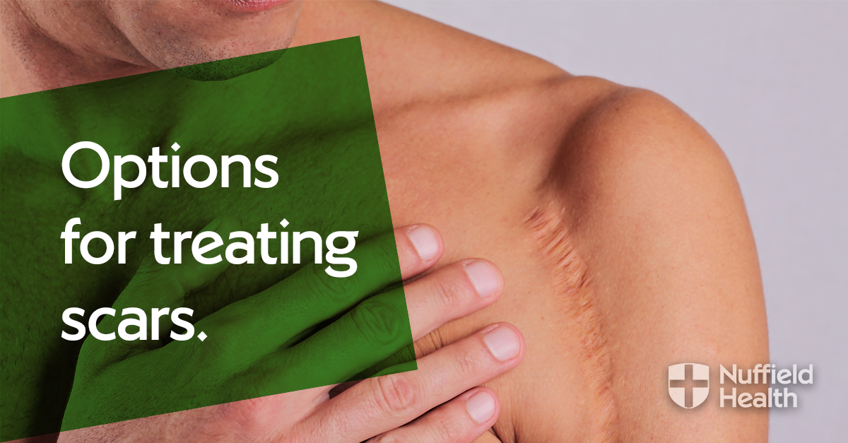 Options for treating scars | Nuffield Health